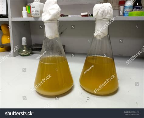 Erlenmeyer Flask Microbiology At Lynda Tawney Blog