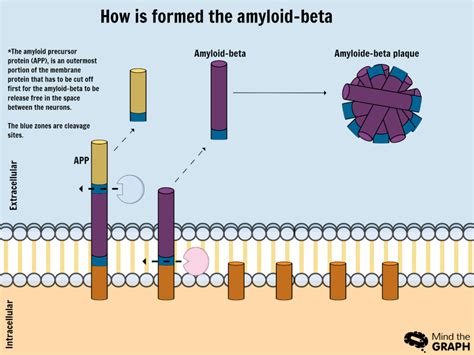 New Theory Tries To Explain The Cause Of Alzheimers