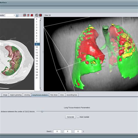 Combination Of Data Representation Techniques In Visual Retrieval Download Scientific Diagram