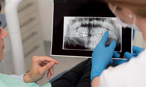 Root Canal Vs Implant What Are The Differenceswhich Is Better
