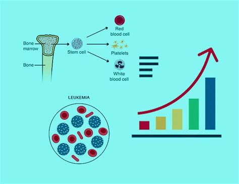 Leukemia Treatment In India Bone Marrow Transplantation