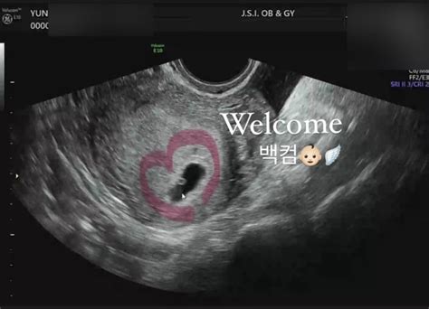 페마라 복용배란10일~18일차진하기초기증상임신 3주차~5주차 임신성공👶🏻🪽 네이버 블로그