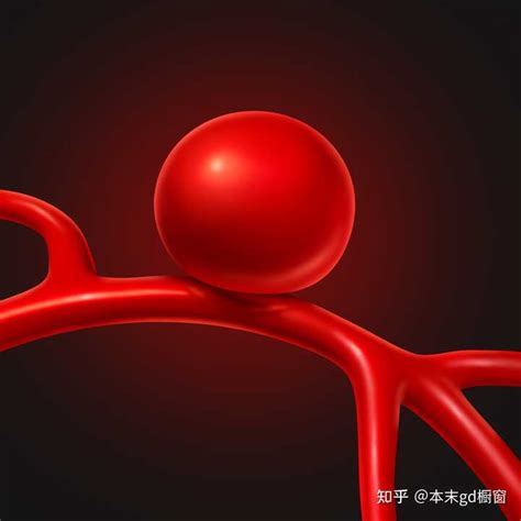 哪些原因会导致血管周细胞瘤？ 知乎