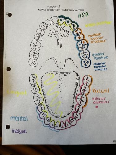 Mandibular Injections Flashcards Quizlet