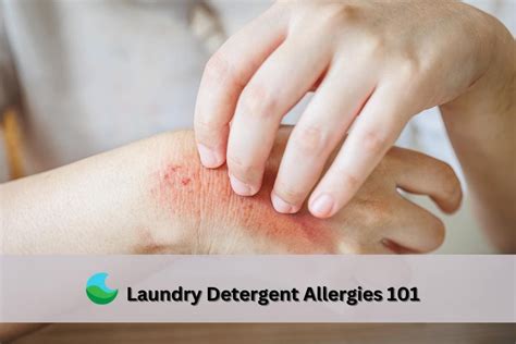 Causes And Management Of Laundry Detergent Allergies Tips For Allergic Reactions Lucent Globe