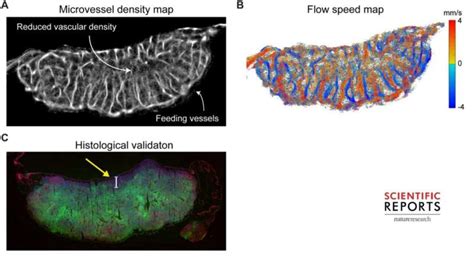 Using Ultrasound Localization Microscopy To Detect Oxygen Levels In Tissues