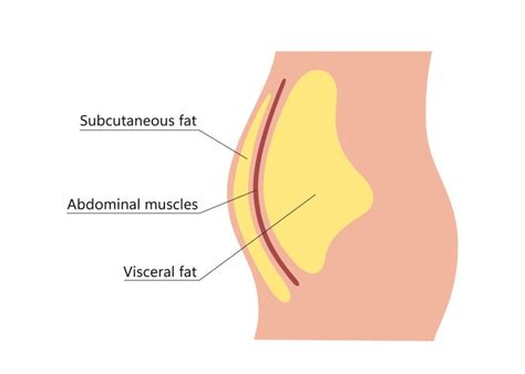 Visceral Fat Diagram Royalty Free Vector Image