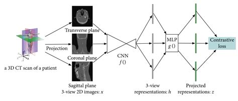 In “multiview Self Supervised The Cancer Imaging Archive