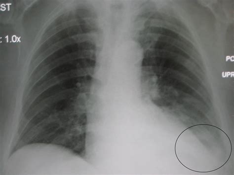 Chest X Ray Interpretation A Structured Approach