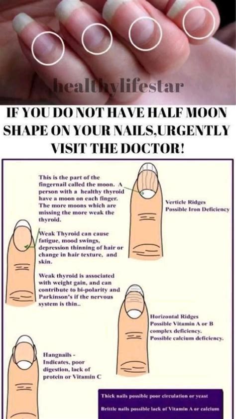 What Do Vertical Ridges On Fingernails Mean Artofit