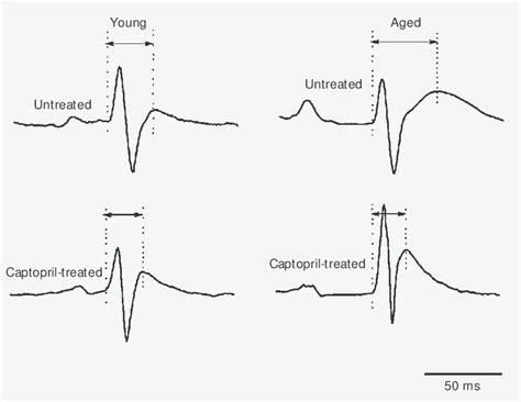 Ecg Tracings Of Representative Rats Of Each Experimental Group The Download Scientific Diagram