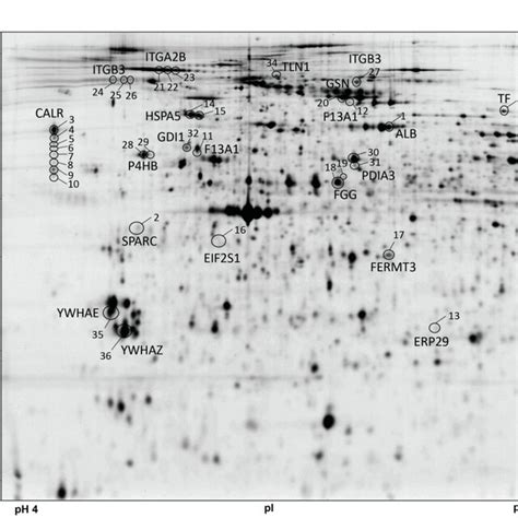 2d Dige Based Proteome Analysis Of Platelets From Patients With Brain