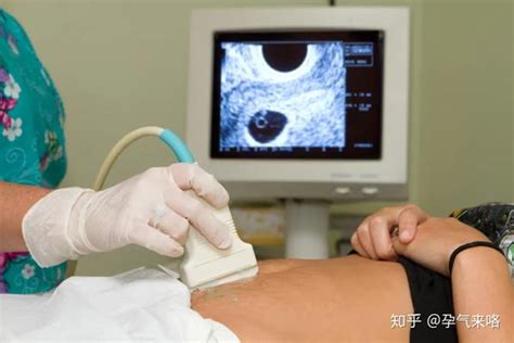 卵泡没发育成熟就排卵还能受孕吗 知乎