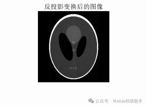 【图像重建】使用fdk的三维谢普洛根幻影重建附matlab代码 fdk重建 csdn博客