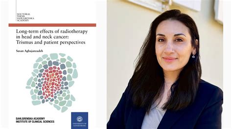 Susan Aghajanzadeh Disputerar På Avhandling Om Långtidseffekter Efter