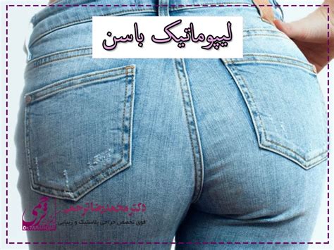 لیپوماتیک باسن روشی نوین برای خوش فرم شدن باسن دکتر محمدرضا ترحمی