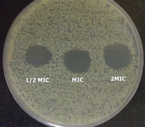 Zone Of Inhibition Of Different Concentration Of Snp Loaded Agar