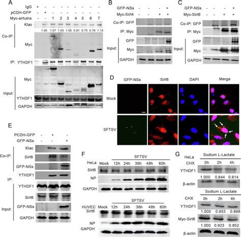 Severe Fever With Thrombocytopenia Syndrome Virus Induces Lactylation