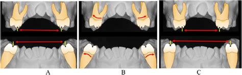 Adult Transverse Diagnosis And Treatment A Case Based Review Pocket