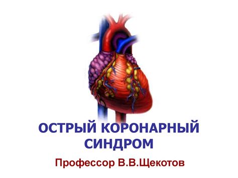 Острый коронарный синдром - презентация онлайн