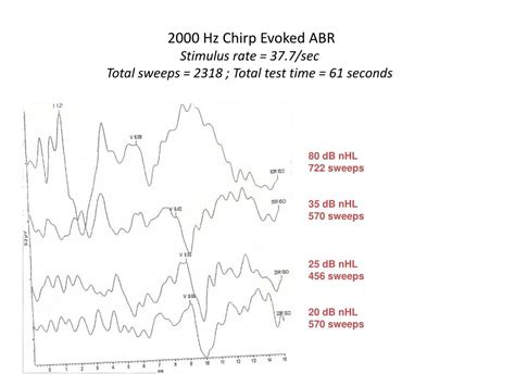Ppt Limitation Of Click Evoked Abr Lack Of Frequency Specificity Powerpoint Presentation Id