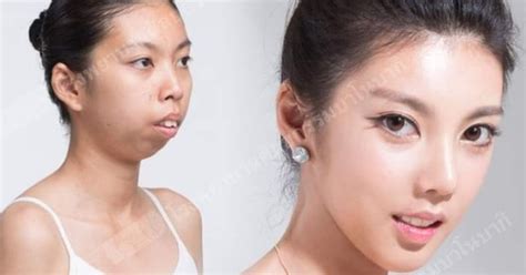 The Difference A Chin Can Do R Ugly