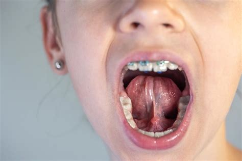 The Hidden Power Of Sublingual Under The Tongue Supplements