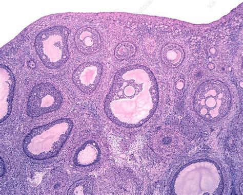 Ovarian Follicles Light Micrograph Stock Image C0456648 Science