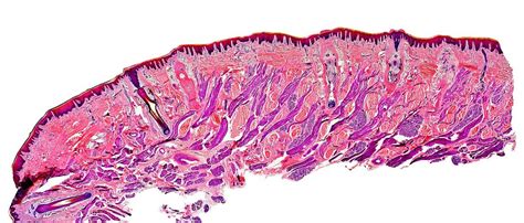 Pig Skinlight Micrograph Bild Kaufen 11681054 Science Photo Library