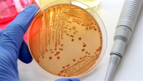 How To Calculate The Rate Of Decay Sciencing