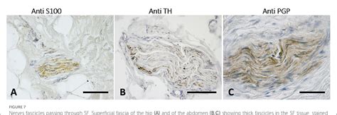 Figure From Innervation Of Human Superficial Fascia Semantic Scholar