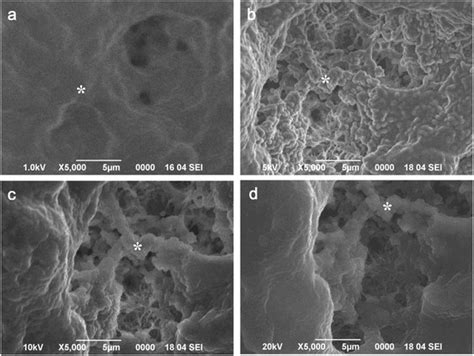 Sem Images Recorded Using Various Accelerating Voltages On The Same Download Scientific Diagram