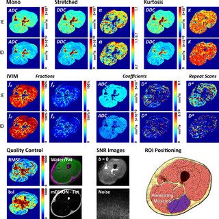 Diffusion Parameter Maps And Region Of Interest ROI Positioning Download Scientific Diagram