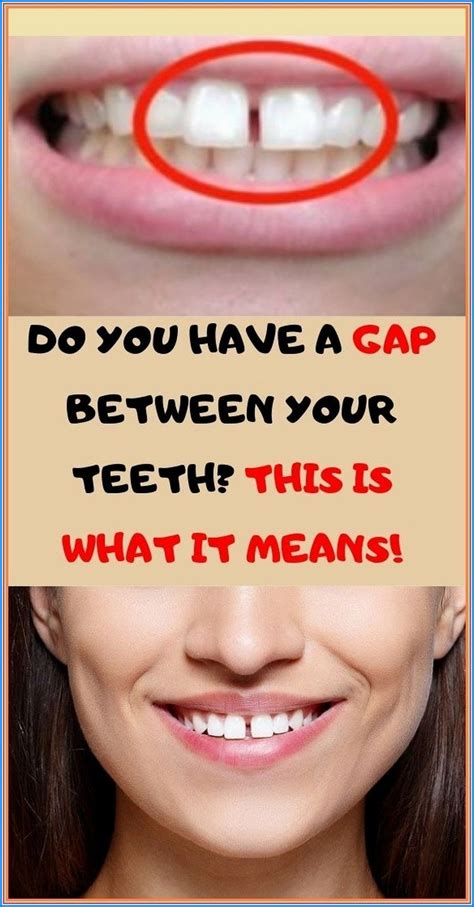 Do You Have A Gap Between Your Teeth This Is What It Means Artofit