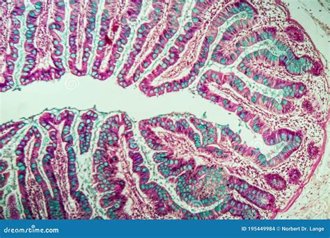 Villi Of Small Intestine Light Micrograph Stock Image Cartoondealer