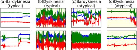 Figure 1 From Data Augmentation Of Wearable Sensor Data For Parkinsons Disease Monitoring Using