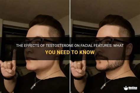 The Effects Of Testosterone On Facial Features What You Need To Know