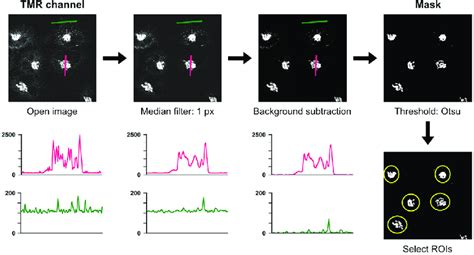 Schematic Illustration Of Imaging Data Processing Download Scientific