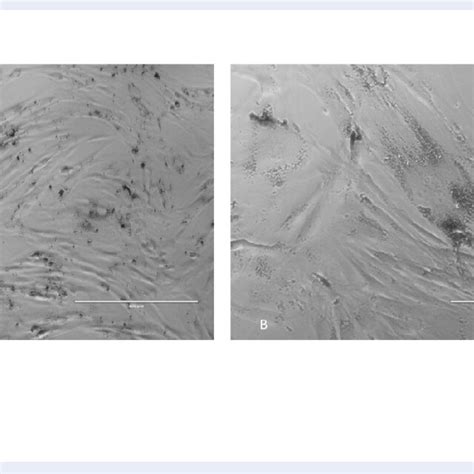 Adipose Derived Stem Cells Loaded With As Prepared Fe 2 O 3 Inverted