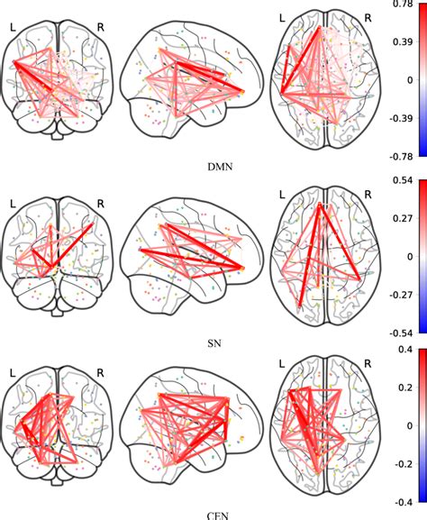The Top 3 Subnetworks Identified By Braingc Net Download Scientific