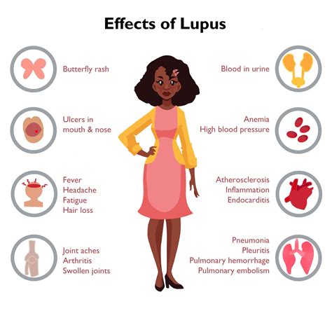 What Is Lupus Pals