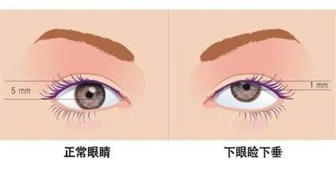 眼睛「乾乾」的，別以為是小事！大病來臨前，身體給你14個預兆，再不注意來不及！