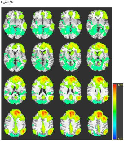 A Average Left Dorsolateral Prefrontal Cortex Connectivity Among Download Scientific Diagram