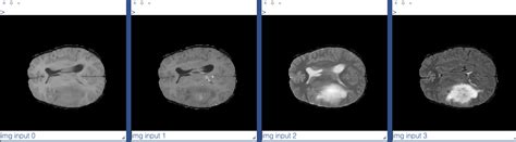 Testing Problems Issue JuliaWolleb Diffusion Anomaly GitHub
