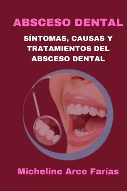 ABSCESO DENTAL S NTOMAS Causas Y Tratamientos Del Absceso Dental By