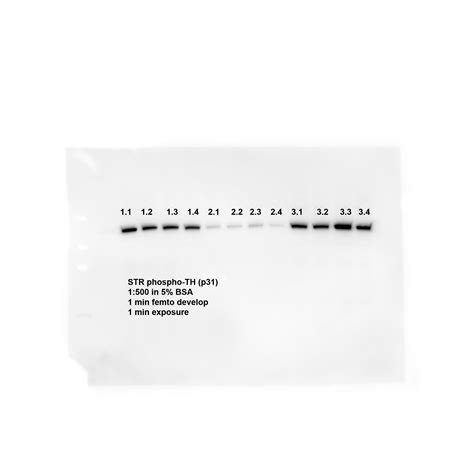 Works Well For Brain Homogenate Mouse Biocompare Antibody Review