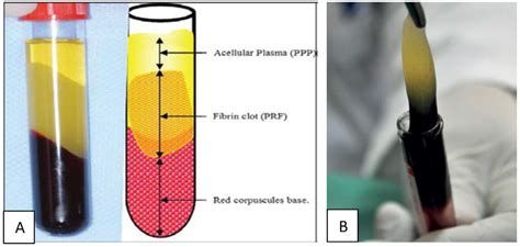 A Layers Of Prf B Layers Of Prf Download Scientific Diagram