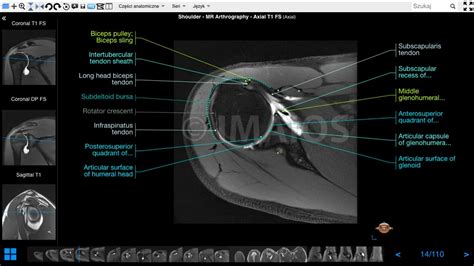 Shoulder Mr Arthrogram E Anatomy