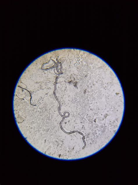 Pinworm Under Microscope