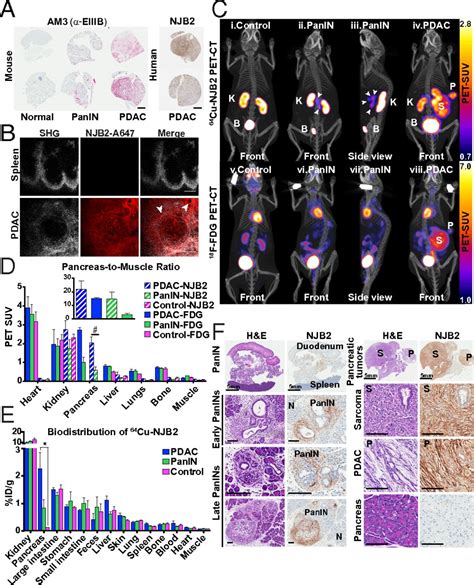 Noninvasive Imaging Of Tumor Progression Metastasis And Fibrosis Using A Nanobody Targeting